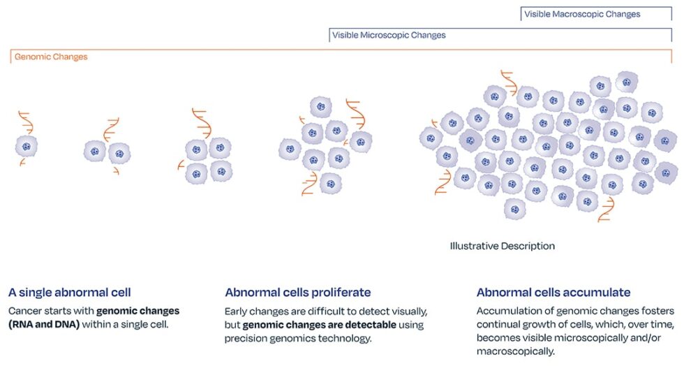 DermTech: Rule Out Melanoma with Precision Genomics